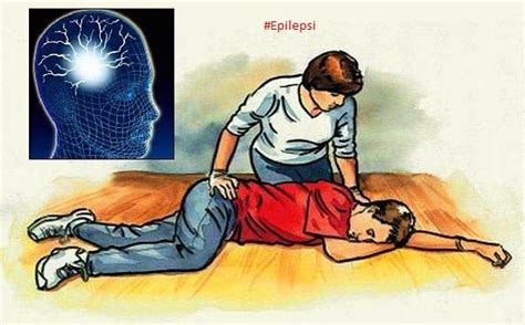 Sizin Müdahaleniz Hayat Kurtarabilir Epilepsi Hastalığını Yakından