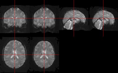 fmri preprocessing using spm 12 spm12r