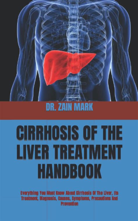 Buy Cirrhosis Of The Liver Handbook Everything You Must Know About