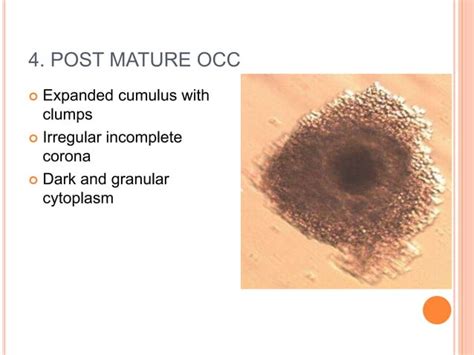 Oocyte Gradingpptx Dhsvsusvshshhshsh Pptx