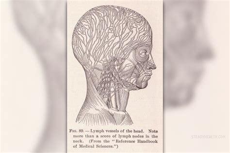 Swollen Lymph Nodes Impactseka