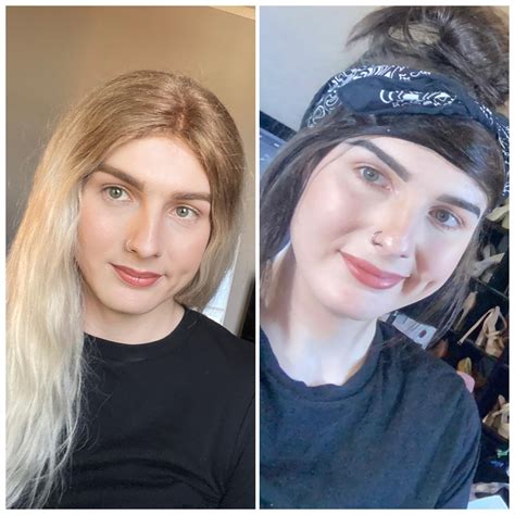The Difference A Year Makes In Fat Redistribution Is Crazy 5 Months Hrt Vs 1 Year 5 Months Hrt