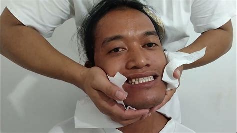 Tmj Case 😱😱 Problem Natatakot Bka Daw Mag Lock Jaw Sya Youtube