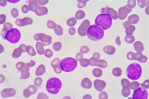 Peripheral Blood Smear Cells