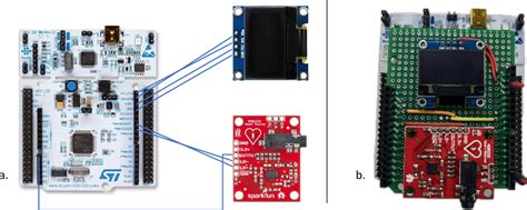 Figure 1 From Real Time Myocardial Infarction Detection Approaches With A Microcontroller Based