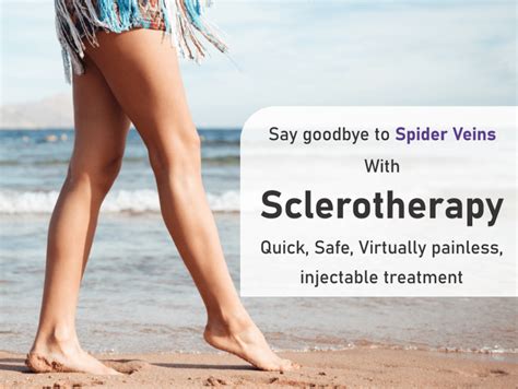 Sclerotherapy Treatment For Spider Veins By Veinhouston Medium