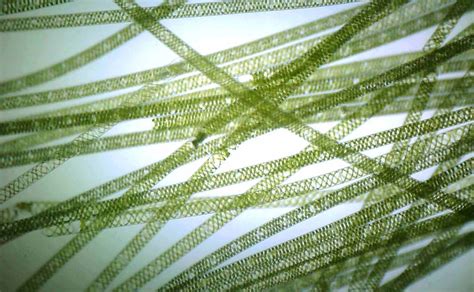 Spirogyra Definition Structure Life Cycle Diagram Rep