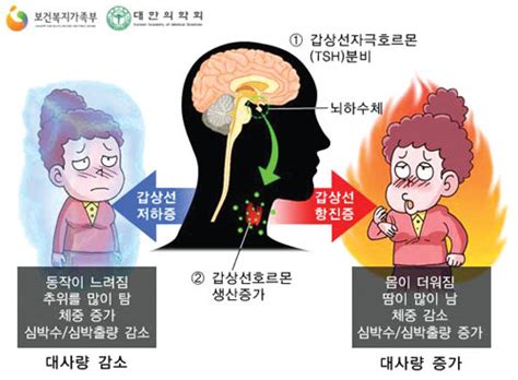 인쇄하기