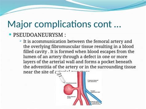 Femoral Artery Access For Catheterization Procedureurepptx