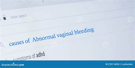 Abnormal Vaginal Bleeding Stock Image Image Of Health 278114035