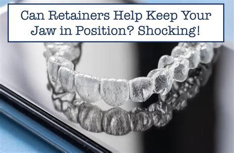 Can Retainers Help Keep Your Jaw In Position Shocking B Weiss Health