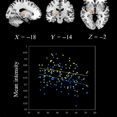 Structural And Functional Neuroimaging Findings In Youths With Ab