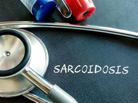 Sarcoidosis What Is Sarcoidosis And What Are Its Causessymptoms
