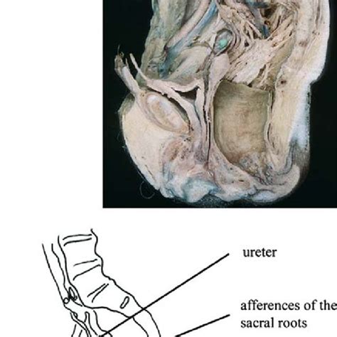 Pdf The Female Inferior Hypogastric Pelvic Plexus Anatomical And Radiological Description
