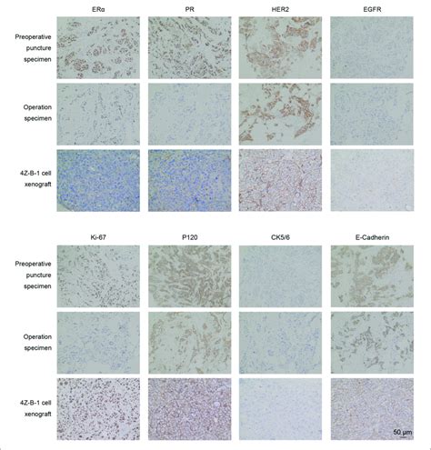 Ihc Analysis Of Original And Xenografted Tumors The Expression Of