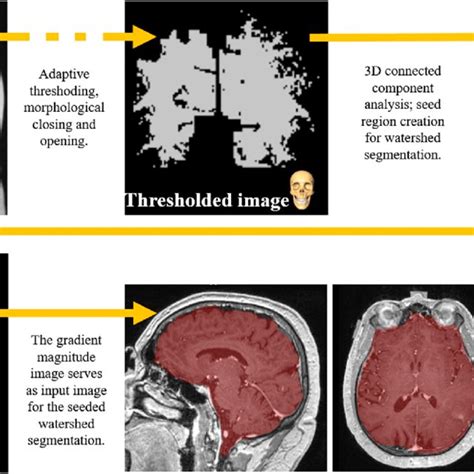 Shows The Main Image Processing Steps Within The Outlined Skull