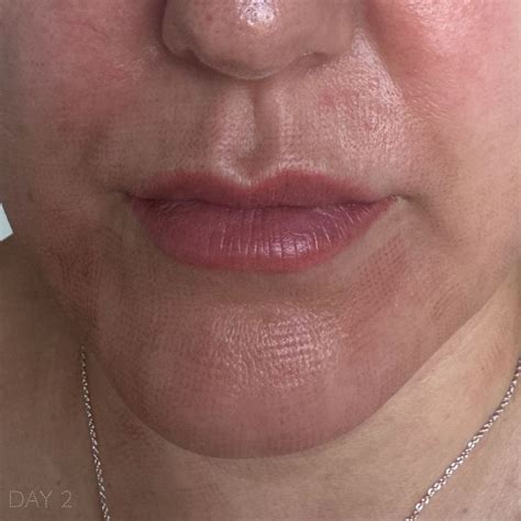 Tixel Skincare Laser Clinic