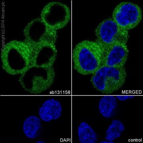 Recombinant Anti Parp1 Antibody Epr18461 Ko Tested Ab191217 Abcam