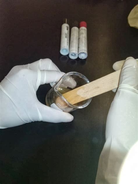 Método de concentración por sedimentación de Ritchie