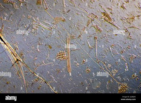 Fossil Diatomsradiolariasponge Spicules Barbados 1800s Rich