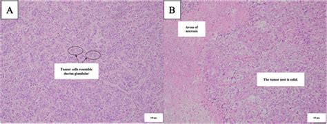 Histological Examination Hematoxylin And Eosin Staining 4×