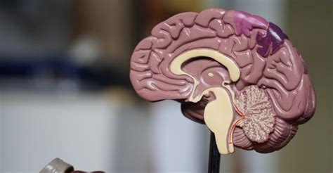 Basal Ganglia Stroke What To Expect And How To Recover Newgait