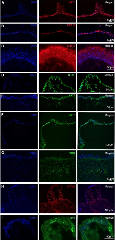 Figure 1 From Single Cell Transcriptomic Analysis Of Corneal Organoids