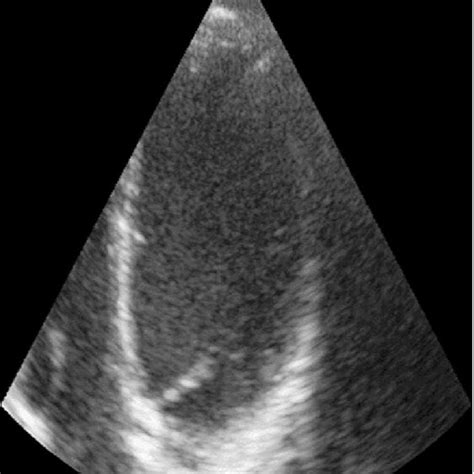 Exemplary Labelled Tte Of The Camus Dataset In A4c Left And A2c View