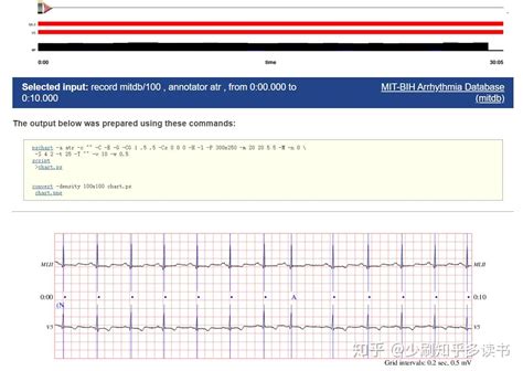 基于机器学习的心律失常分类二——读取mit Bih数据库中的心电数据 Matlab 知乎