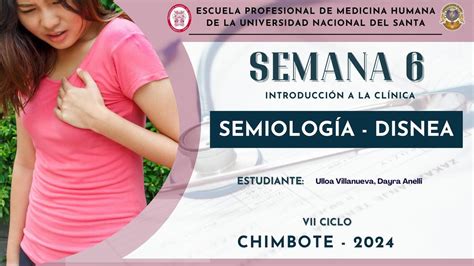 Disnea Dayra Anelli Udocz