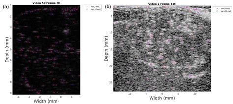 Localization Results For In Vivo Dataset A In Vivo Rat Brain B In