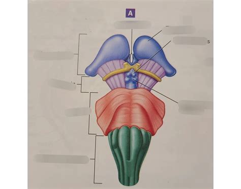 Dicephalon N Brainstem Quiz