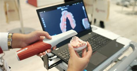 Neoss Unveils Novel Implant Solutions Neoscan 2000 And Neotell