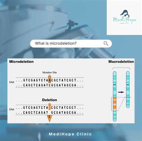Microdeletion Syndromes By Nipt Non Invasive Prenatal Testing