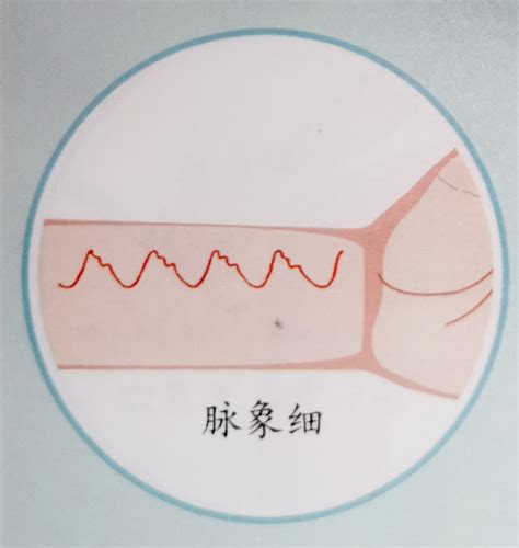 腰痛的脉象表现 知医邦