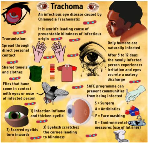 India Has Eliminated Trachoma As A Public Health Problem Who Pwonlyias