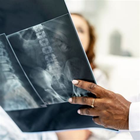 Understanding Two Level Acdf Surgery