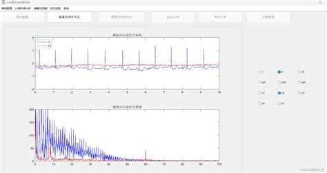 【心电信号】基于matlab Gui心电图自动诊断【含matlab源码 3074期】matlab心电图 Csdn博客