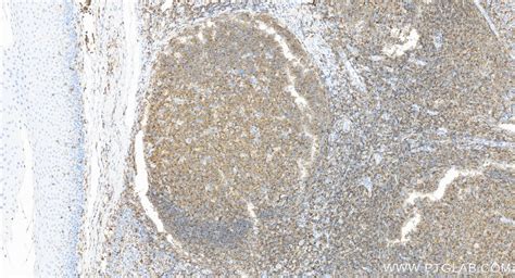 Cd45 Antibody 84405 6 Rr Proteintech
