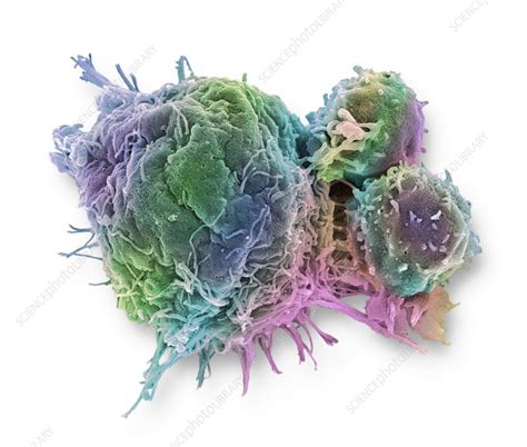 Cancer Cell And T Lymphocytes Sem Stock Image F0128937 Science