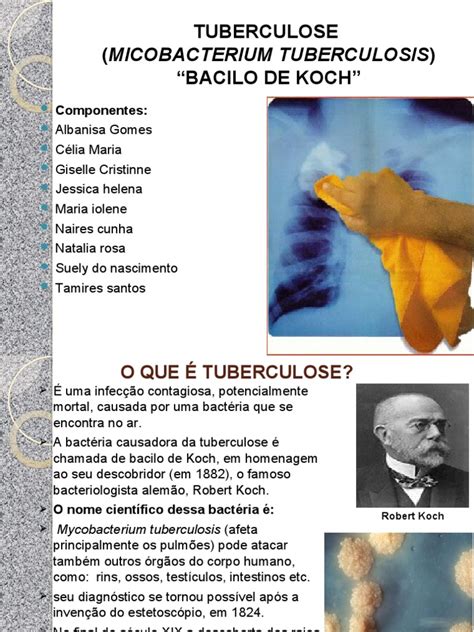 Tuberculose Mycobacterium Tuberculosis Bacilo De Koch