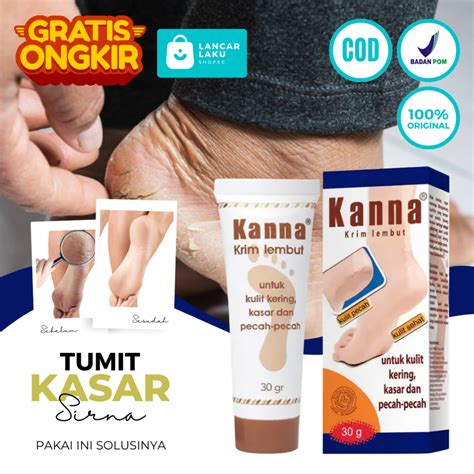 Jual ORIGINAL Kanna Cream Kaki Obat Krim Kaki Pecah Pecah Dan