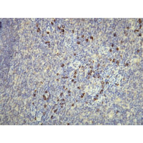 Anti Human Kappa Light Chain Antibody [a21 Y] A8191