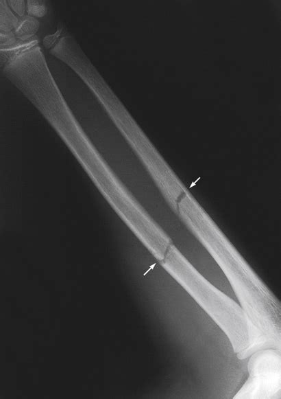 Trauma Radiography