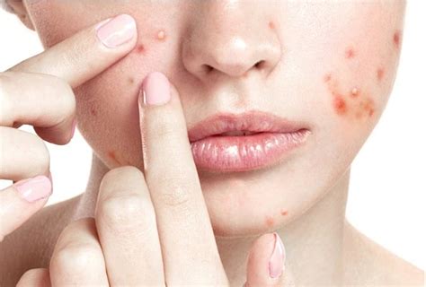 마녀공장 블레미쉬 레드 아크네 폼 100 Ml 민감성 피부 사용 테스트 완료 마녀공장 花瓣网