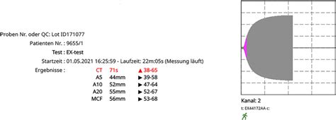 Elastic Motion Thrombelastography Teg Clotpro® Enicor Gmbh Munich