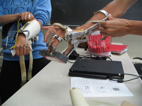 Extensor MCP Dynamic Action Splint And Tenodesis Brace Flickr