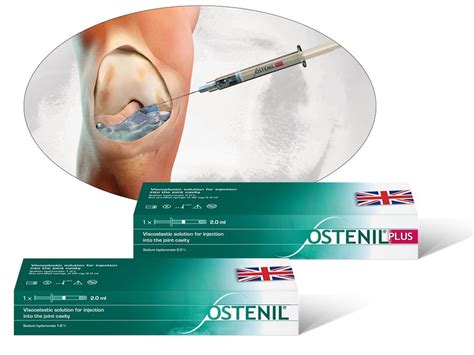 Physiomsk Viscoelastic Joint Injections