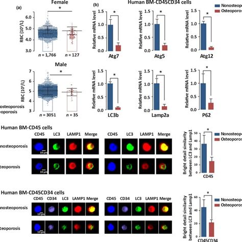 proteomic profiling of tibia bone of hematopoietic autophagy‐defective download scientific