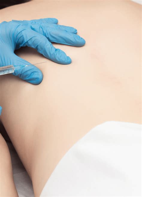 Trigger Point Injection Musculoskeletal Conditions RAD Clinic